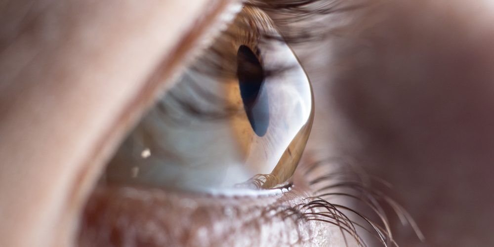 Corneal Transplantation: A Comprehensive Guide